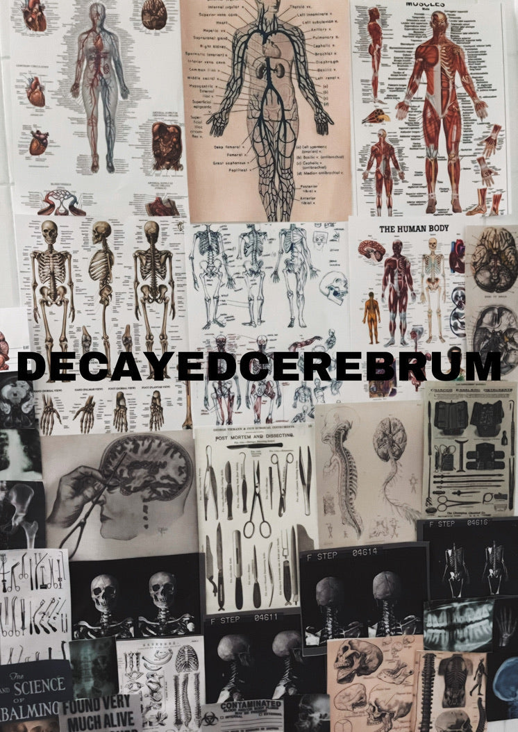 All items – DECAYEDCEREBRUM